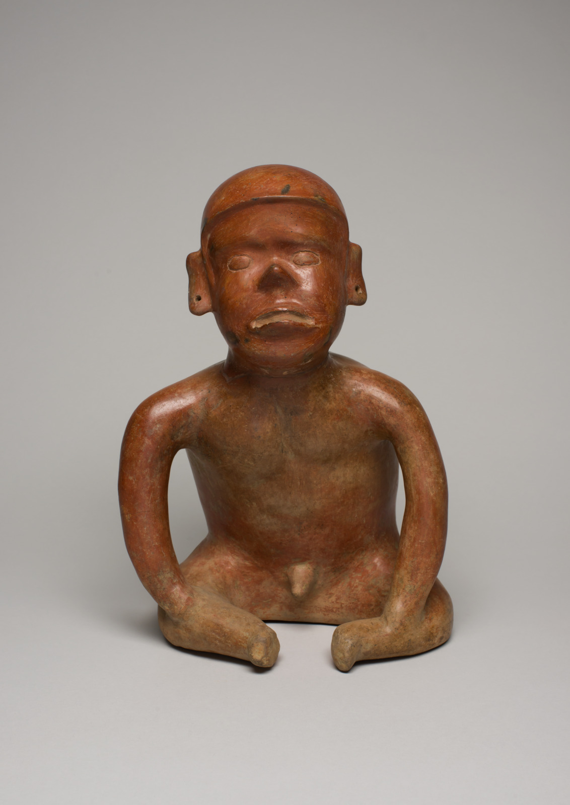 Seated Male Hunchback - Saint Louis Art Museum